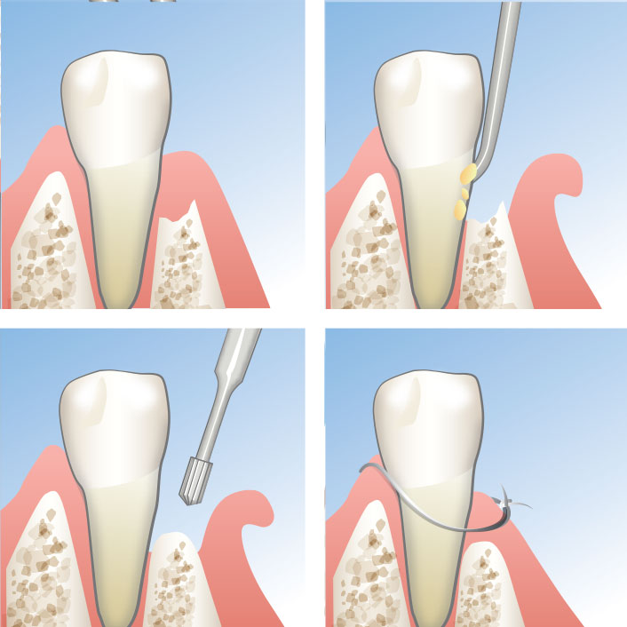 Osseous Surgery Near Me Lincoln MA 01773